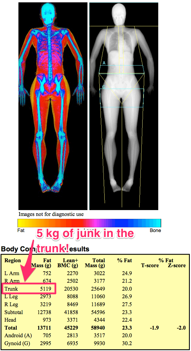 How a DEXA Body Fat, Muscle, and Bone Scan Can Help You Get Fit